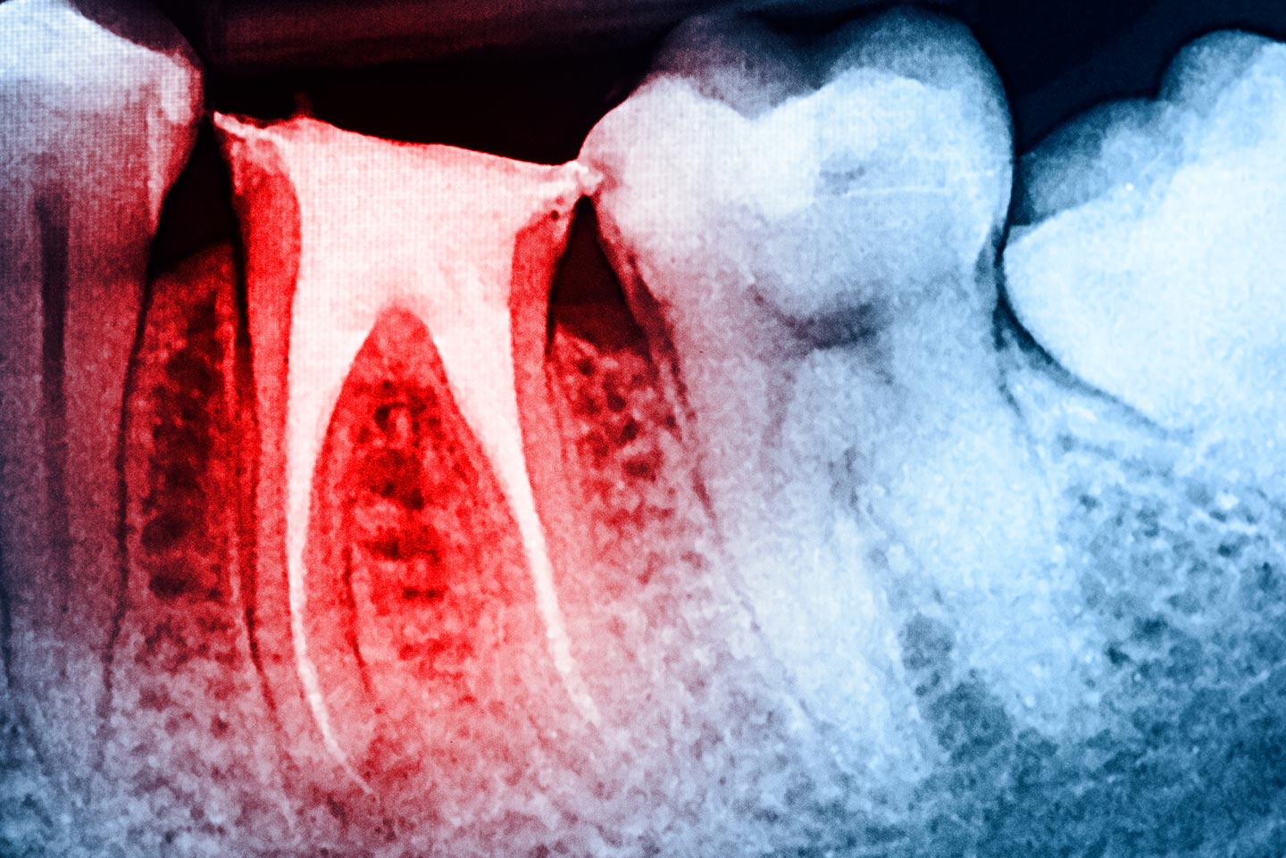 Endodontologie